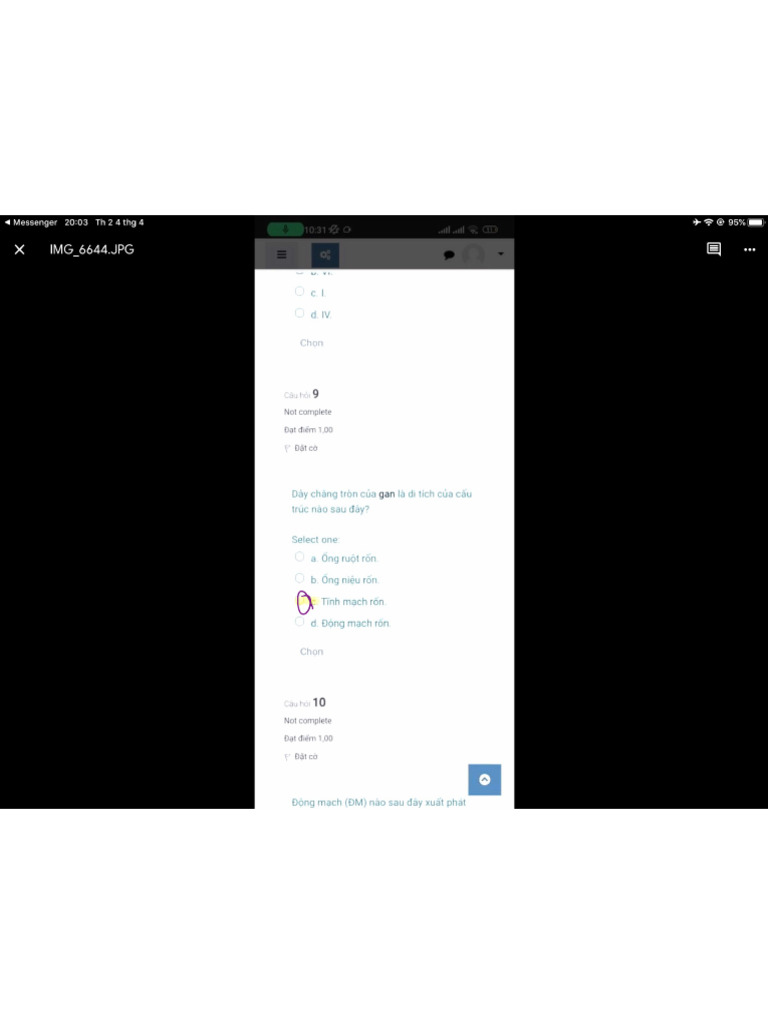 giữa kỳ M11 | PDF