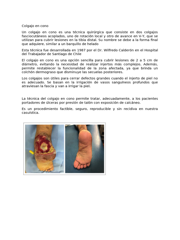Colgajo | PDF