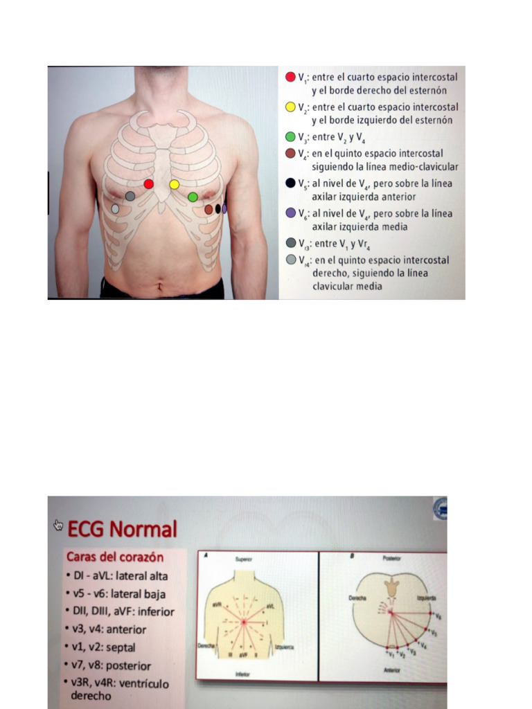 EKG | PDF