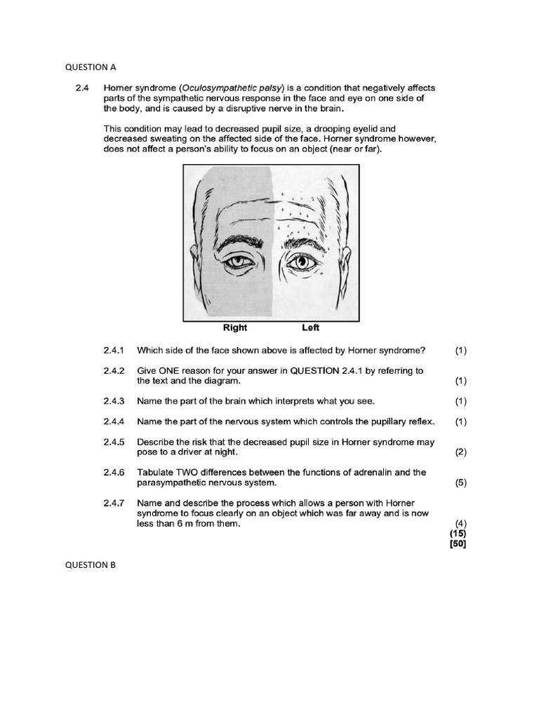 Human Eye Activities D | PDF