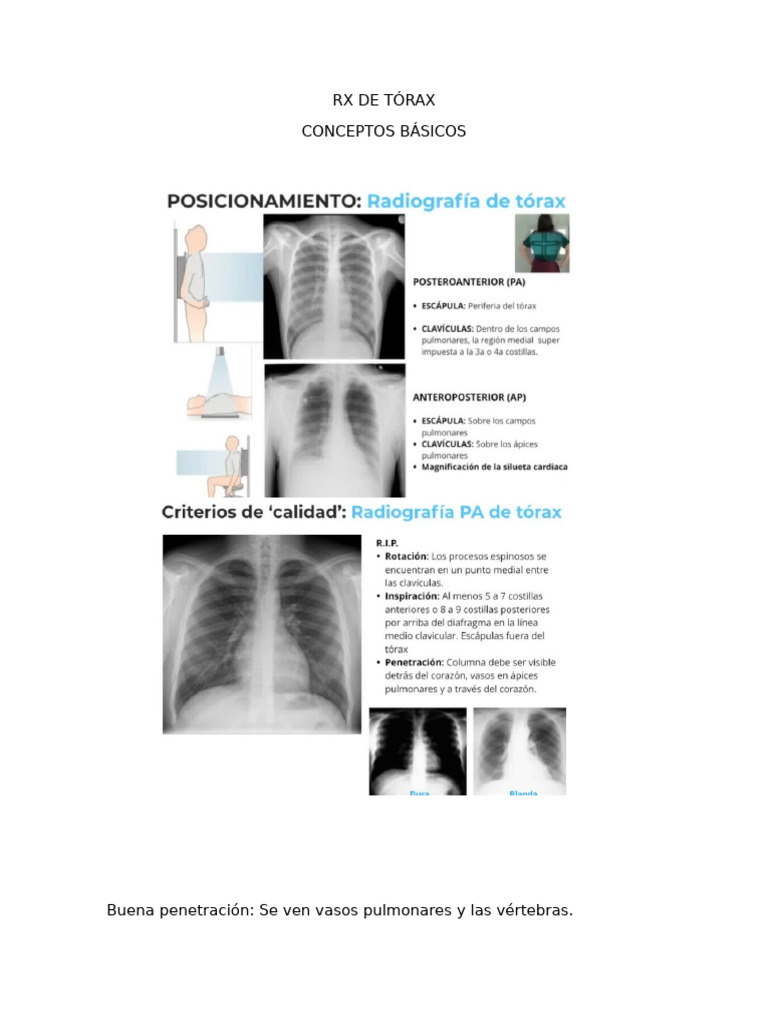 I1-RX DE TORAX | PDF