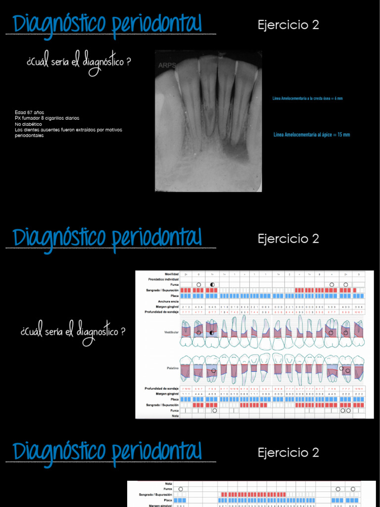 Ejercio 2 DX PERIODONTAL | PDF
