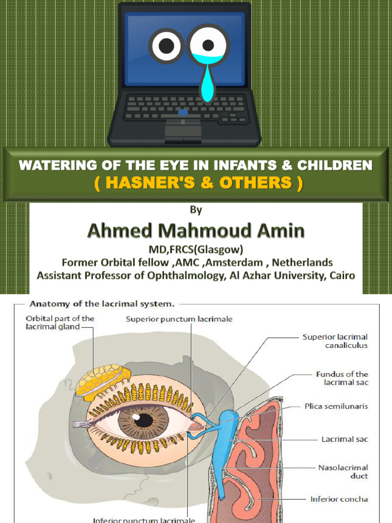 Congenital NLD Obstruction | PDF | Medical Specialties | Clinical Medicine