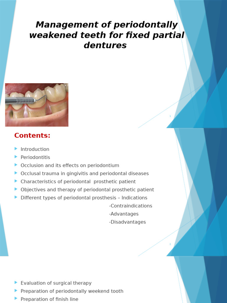 Management of Periodontally Weak Tooth | PDF | Periodontology | Human Tooth