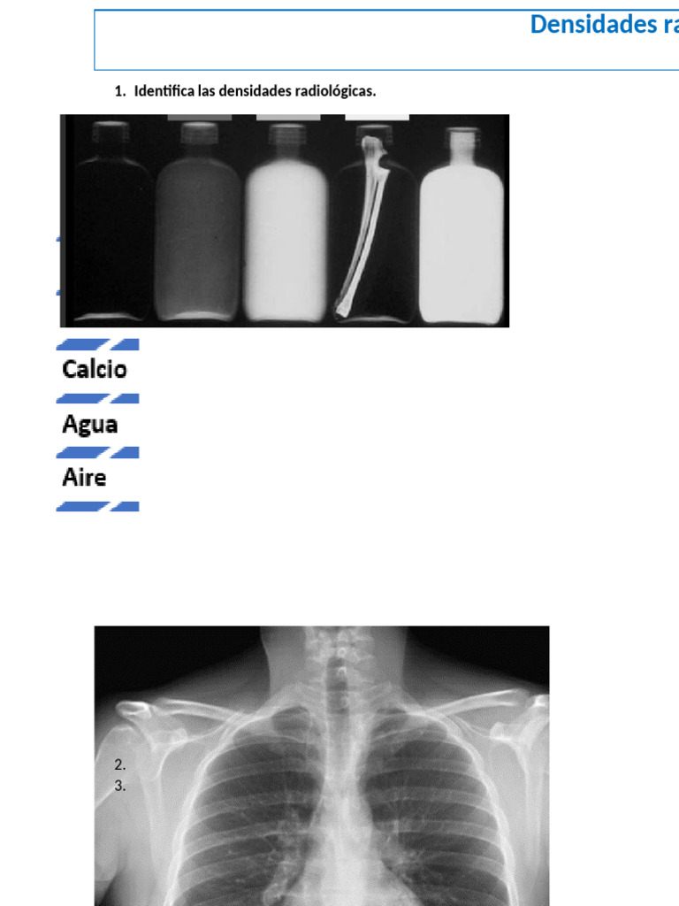 1°P - Sem 1-Sesion 3 y 4 Identifica Las Densidades Radiológicas | PDF