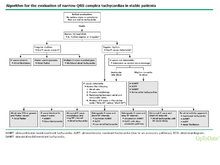 Evaluation Narrow QRS Complex Tachycardias in Stable Patients | PDF