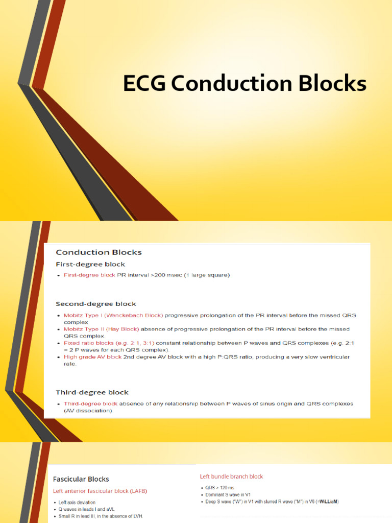 conduction defect | PDF | Electrocardiography | Cardiovascular Diseases
