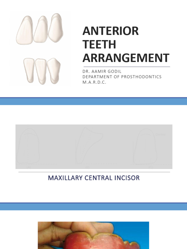 Anterior Teeth Arrangement - Preclinics | PDF | Primate Anatomy | Dentistry