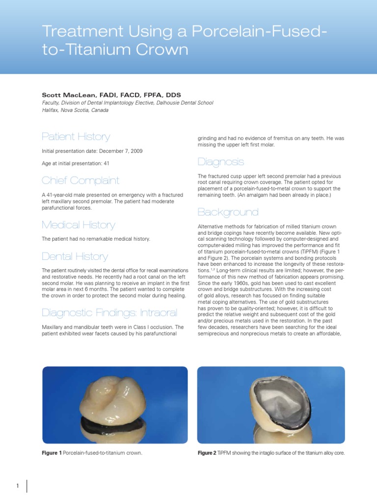 Treatment Using A Porcelain-Fused-to-Titanium Crown: Patient History ...