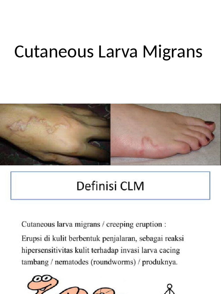Cutaneus Larva Migrans | PDF