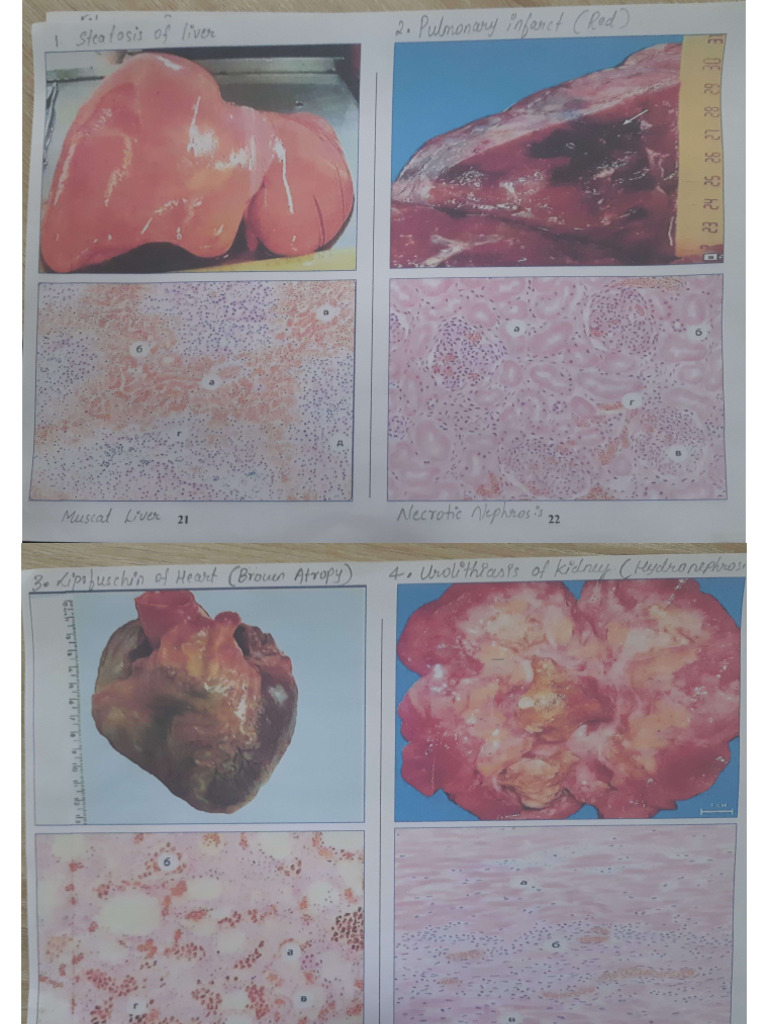 Pathoanatomy Slides | PDF