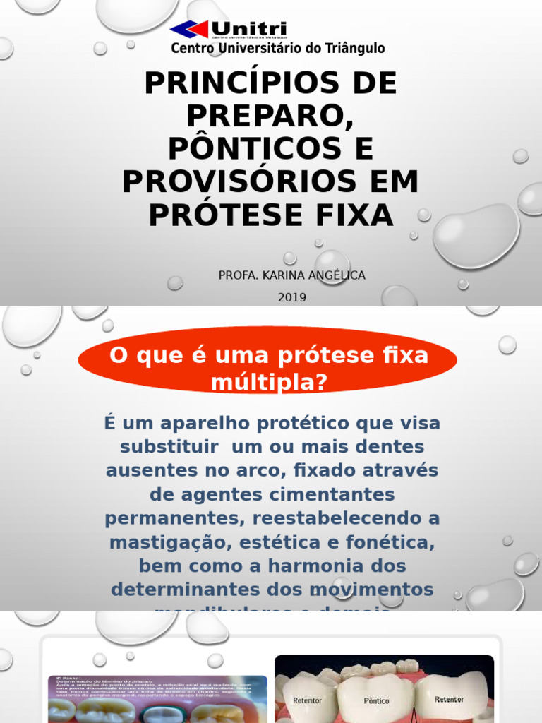 Princípios do Preparo em Prótese Fixa | PDF | Dente humano | Prótese