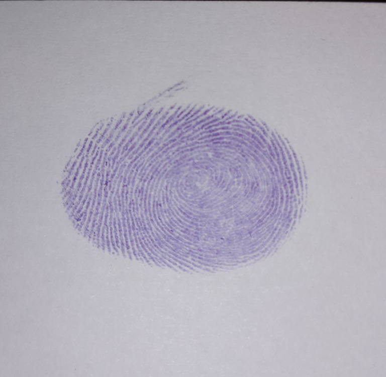 Right Thumb Impression | PDF