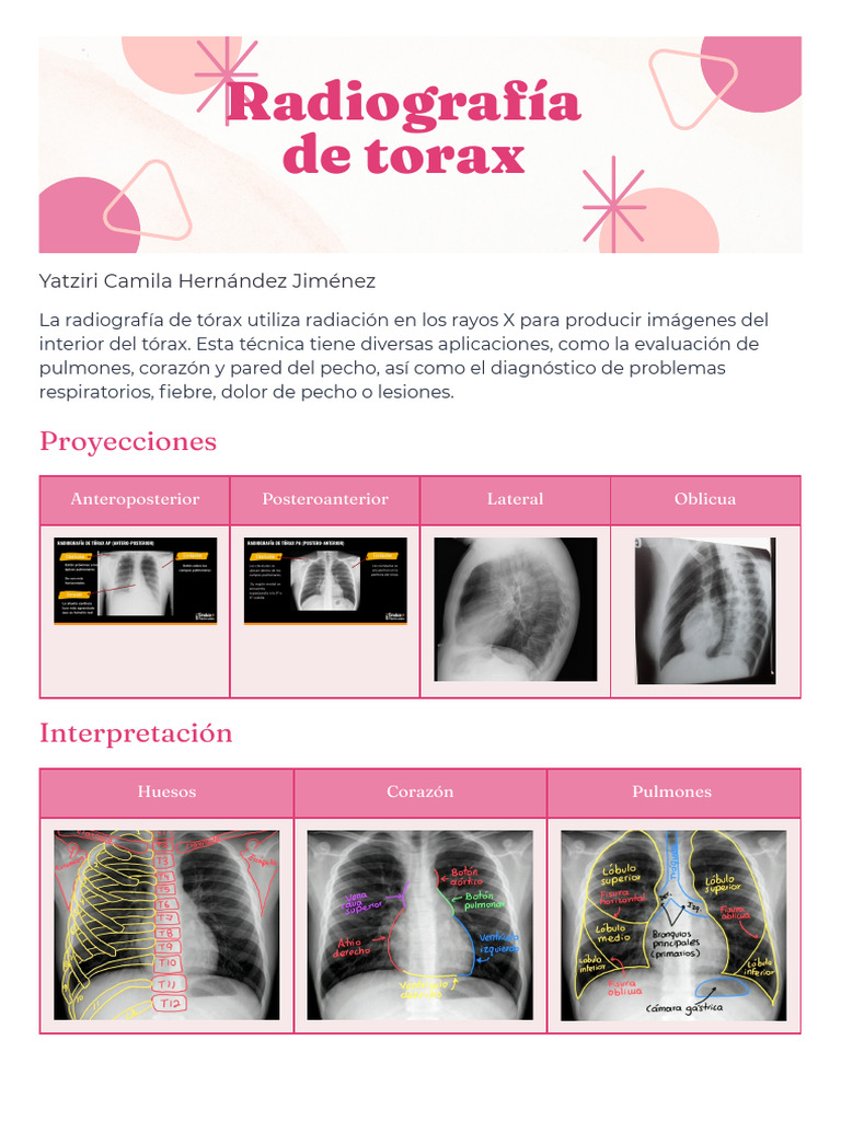 Radiografía de Torax | PDF