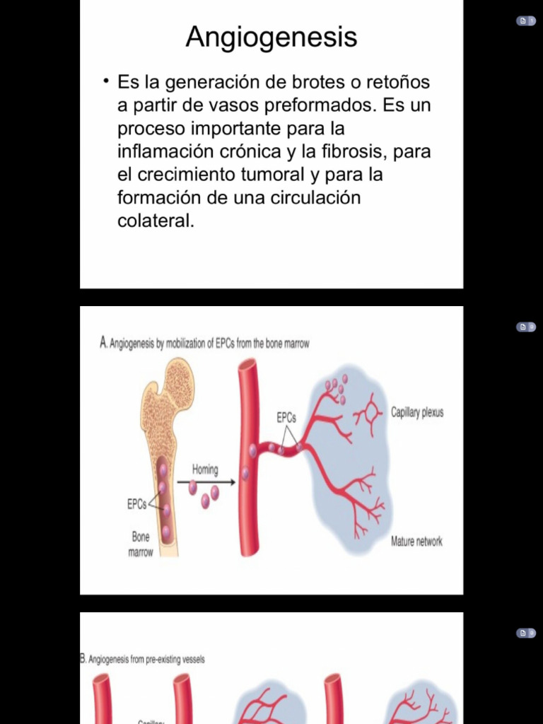 Angiogenesis Patologia Humana | PDF