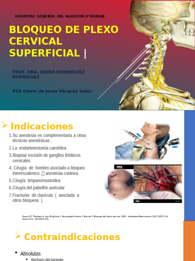 Bloqueo de Plexo Braquial Superficial | PDF | Anatomía humana | Sistema ...