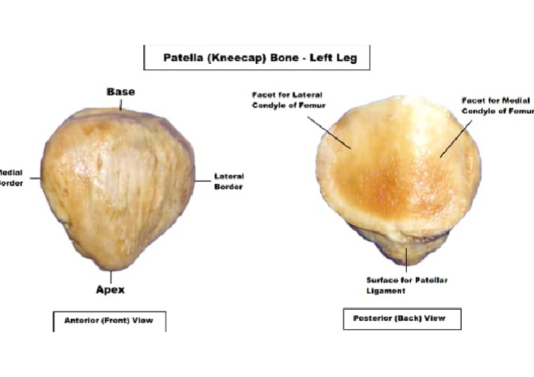 Patella Bone | PDF