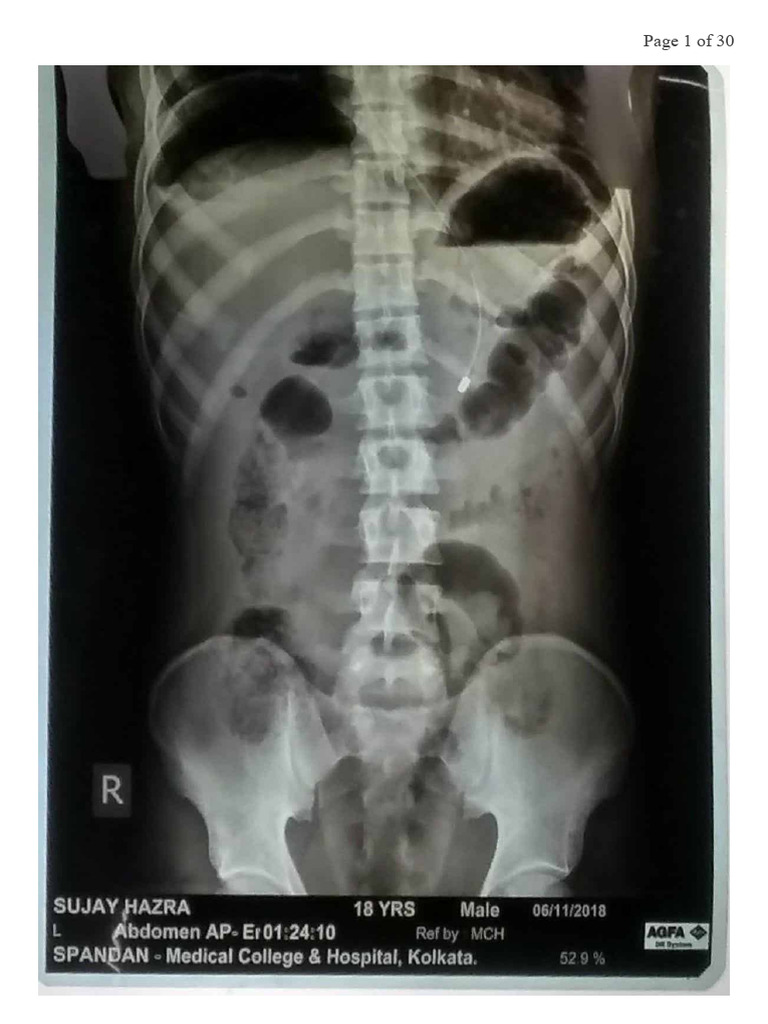 Surgery X Ray | PDF