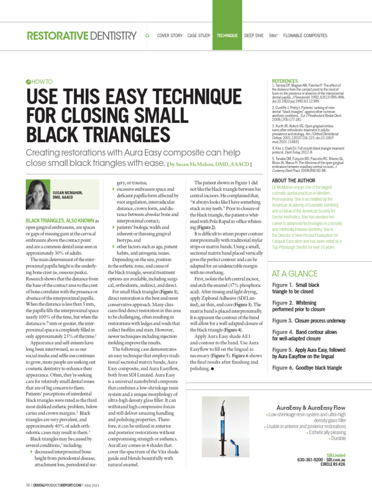 2021 RESTORATIVE DENTISTRY - Closing Small Black Triangles With Aura ...