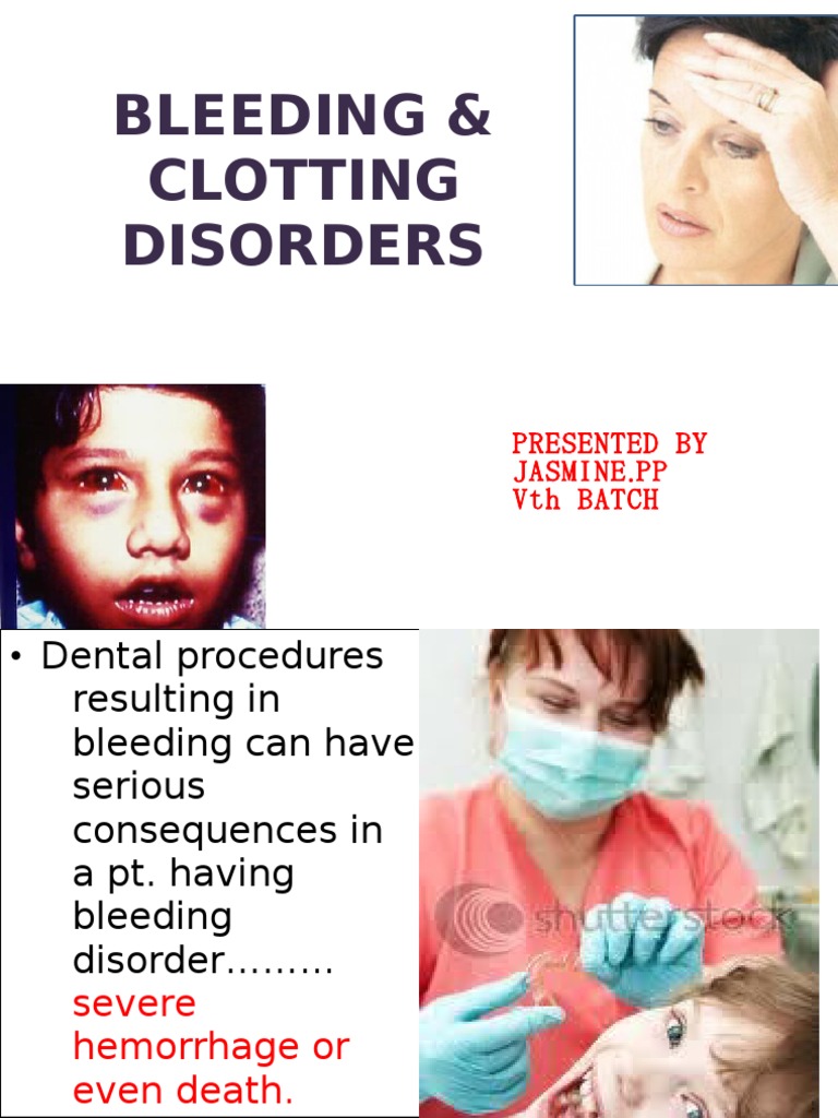 Bleeding Clotting Disorders | PDF | Coagulation | Bleeding