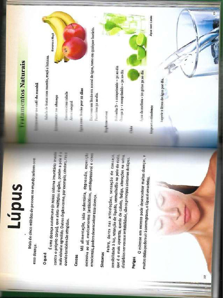 Lúpus | PDF