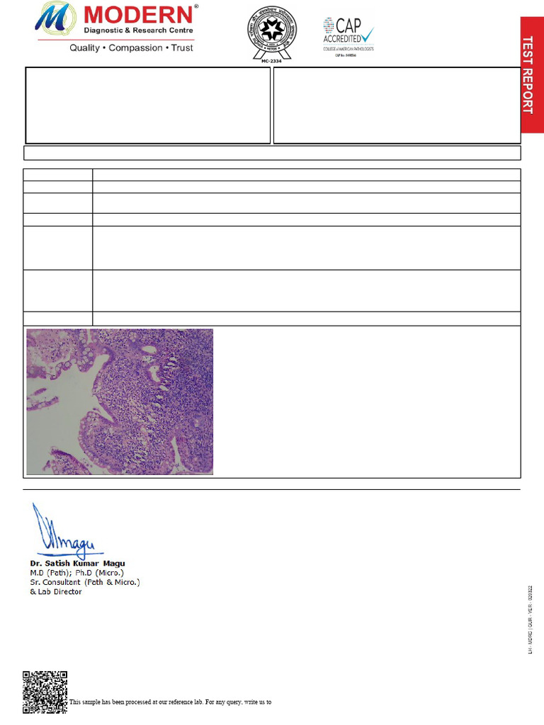 Non-Specific Chronic Ileitis Report | PDF