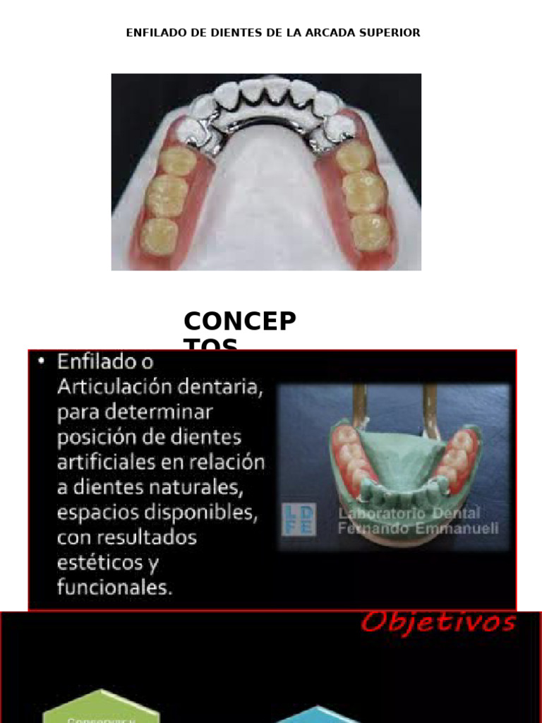 9 Enfilado 1 de Dientes Artificiales | PDF