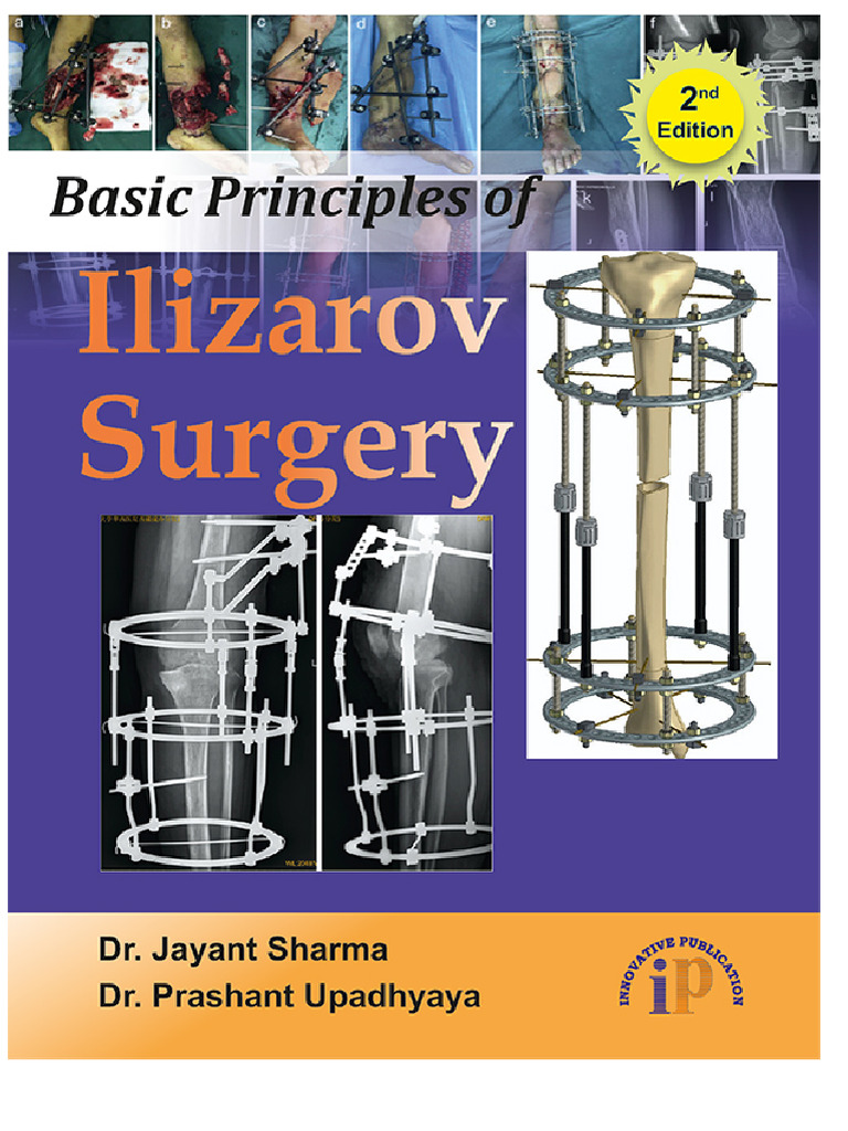 Basic Principles of Ilizarov Surgery (2e) 23 | PDF