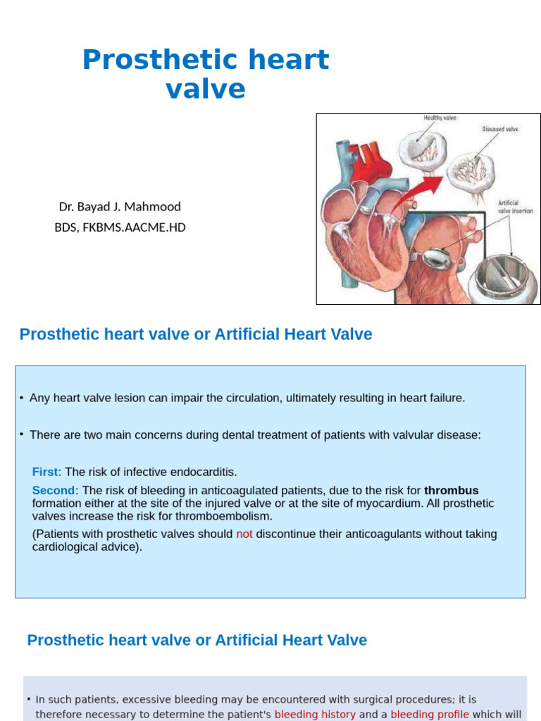 Prosthetic Heart Valve | PDF | Heart | Internal Medicine