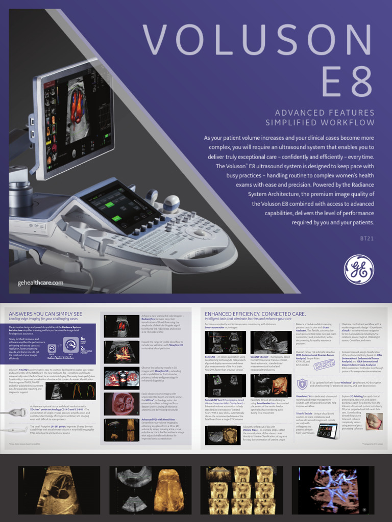 Voluson E8 BT21 Brochure | PDF | 3 D Computer Graphics | Medical Ultrasound
