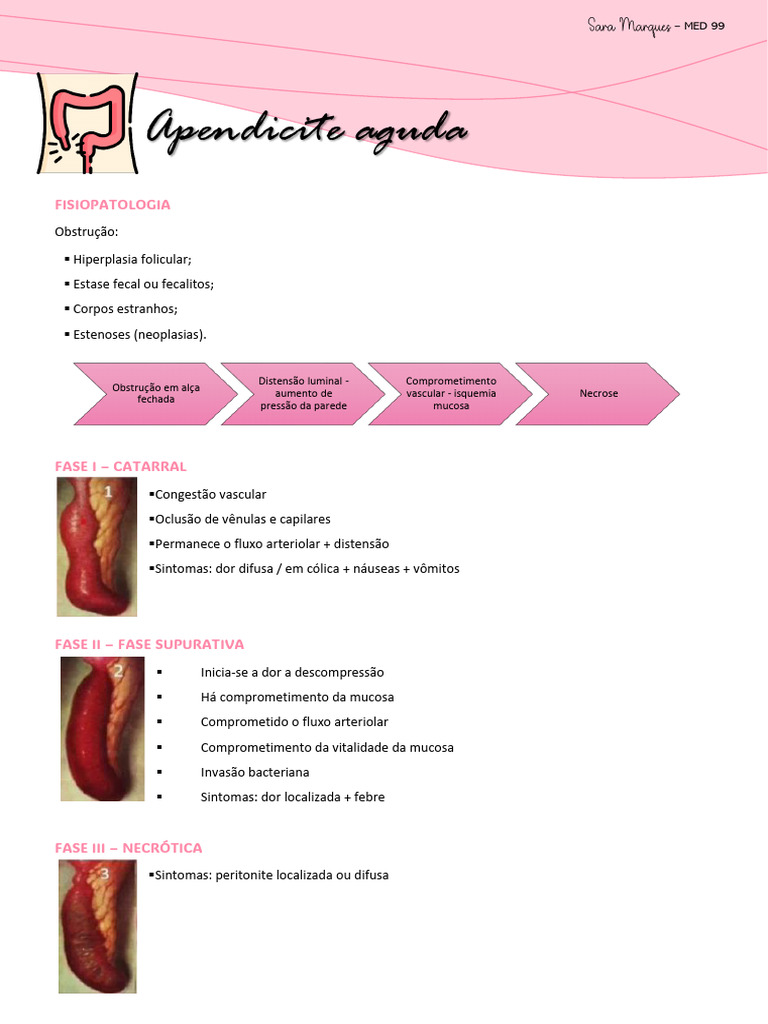 APENDICITE | PDF | Doenças e distúrbios | Especialidades médicas