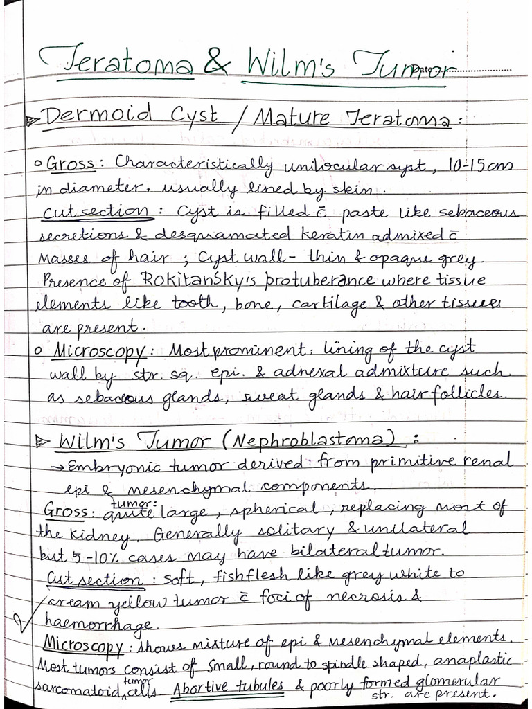 Teratoma and Wilms tumor | PDF