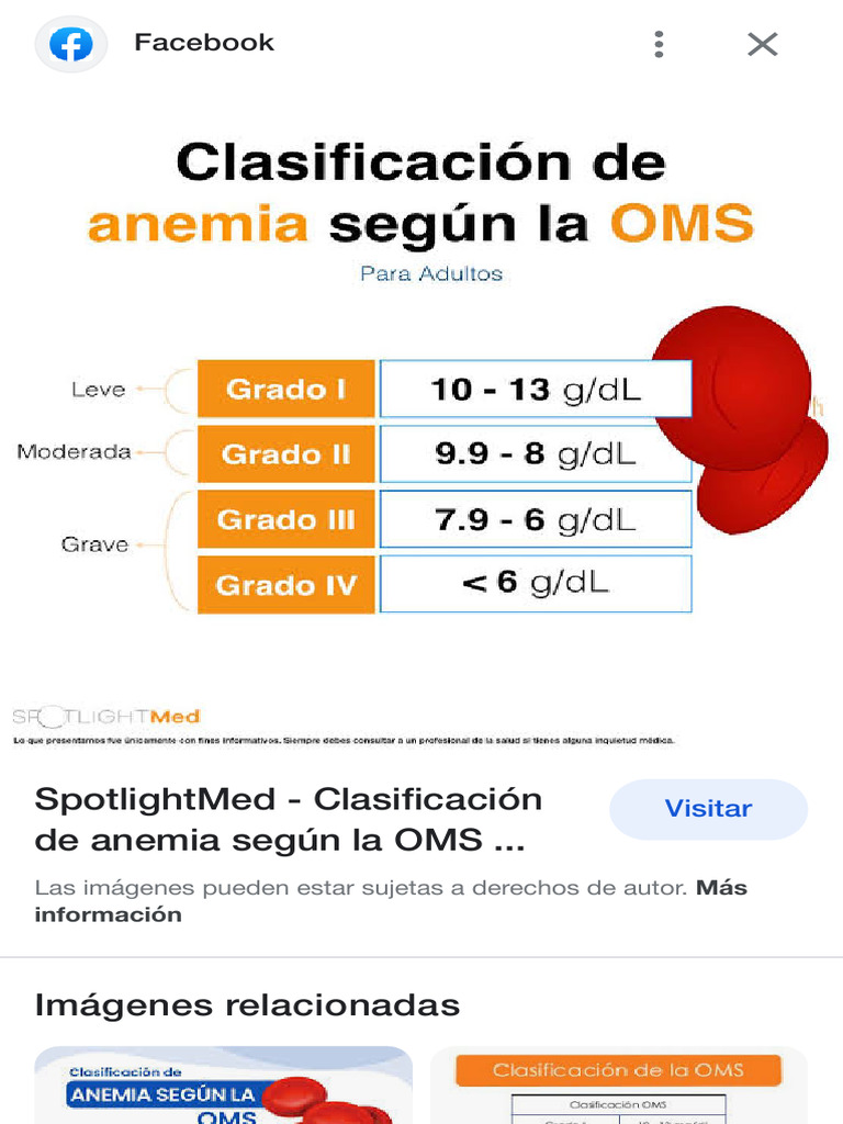 Clasificación OMS de Anemia | PDF