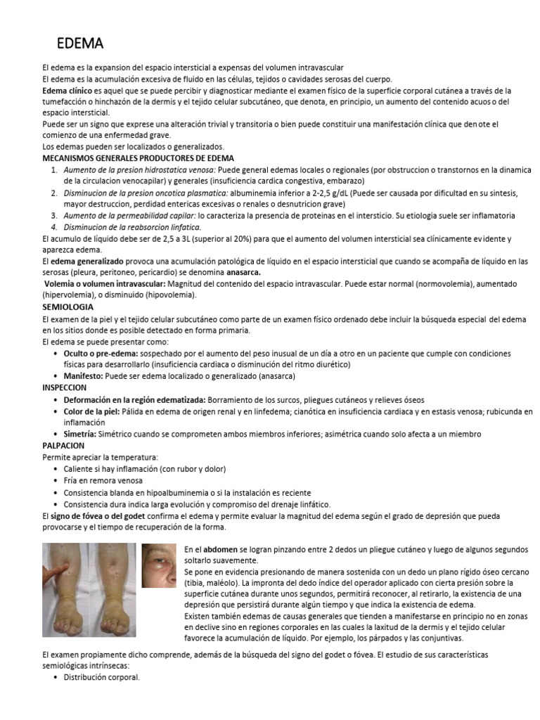 Edema | PDF | Edema | Especialidades Medicas
