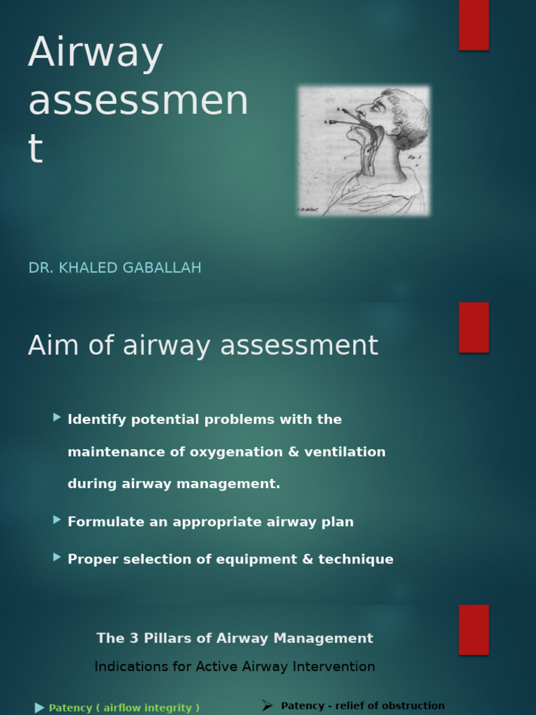 Airway Assessment2 - 094035 | PDF | Clinical Medicine | Diseases And ...