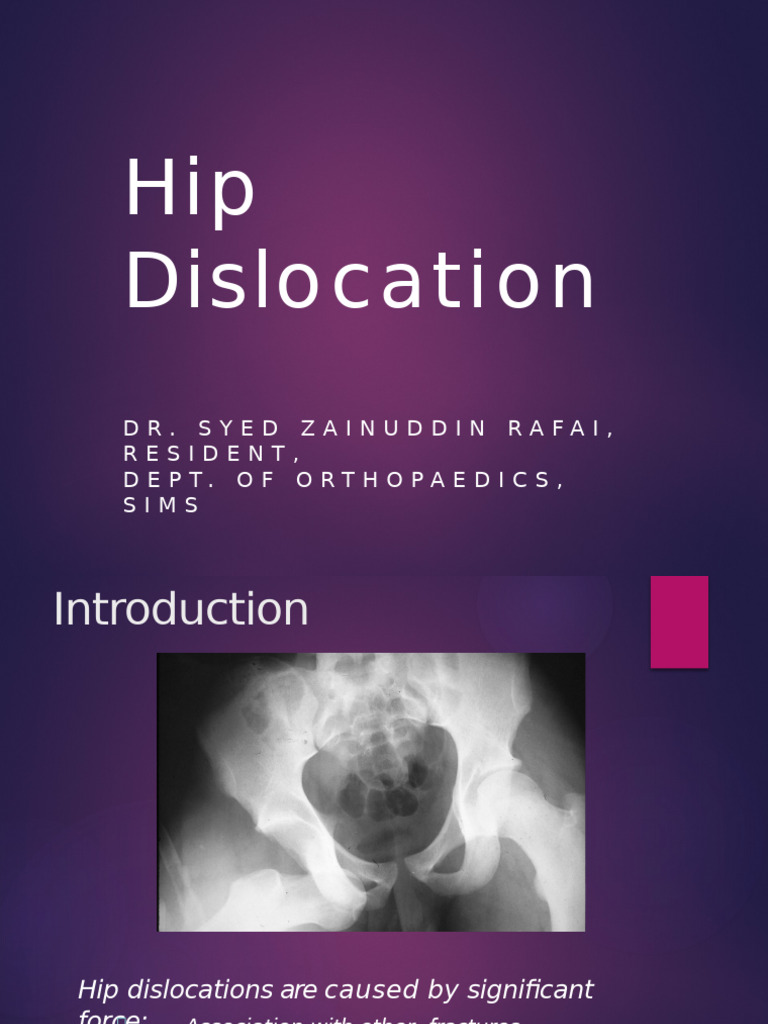 Hip Dislocation | PDF | Hip | Anatomical Terms Of Motion