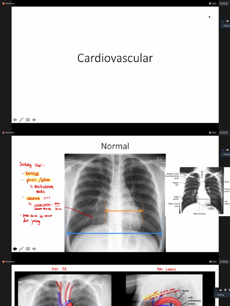 6 - Imaging Kardiovaskular Dan Intervensi | PDF