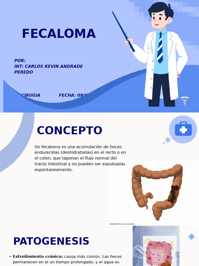 FECALOMA | PDF | Enfermedades y trastornos | Especialidades Medicas