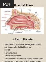 Panduan Hipertrofi Konka Hidung | PDF | Sains & Matematika