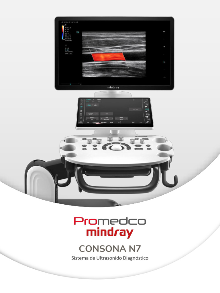 CTZ 250205-7 - Consona N7 RD - Clinica Nevado | PDF | Ultrasonido | Radiología