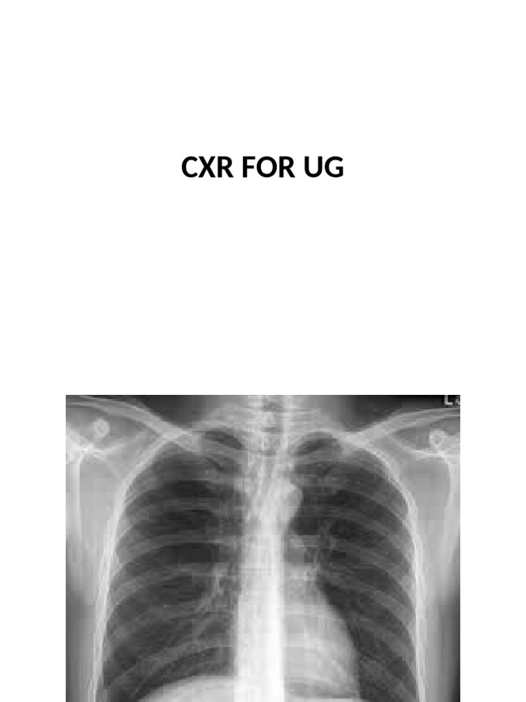 CXR For Ug | PDF