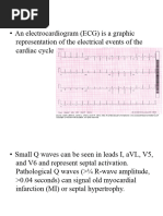 STEMI 12 Lead ECG Analysis Guide | PDF | Electrocardiography | Visual ...