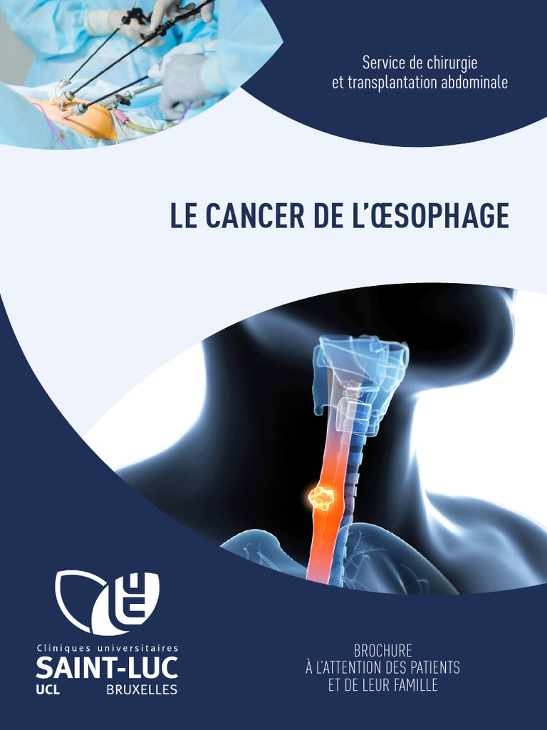 Guide sur le cancer de l'œsophage | PDF | Cancer de l'œsophage | Cancer