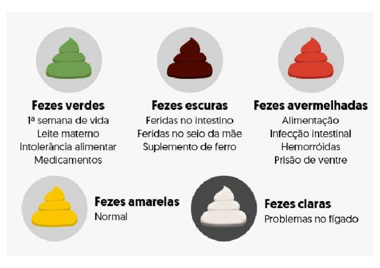 o Que Pode Causar Alteracoes Nas Fezes Do Bebe 29290 l | PDF