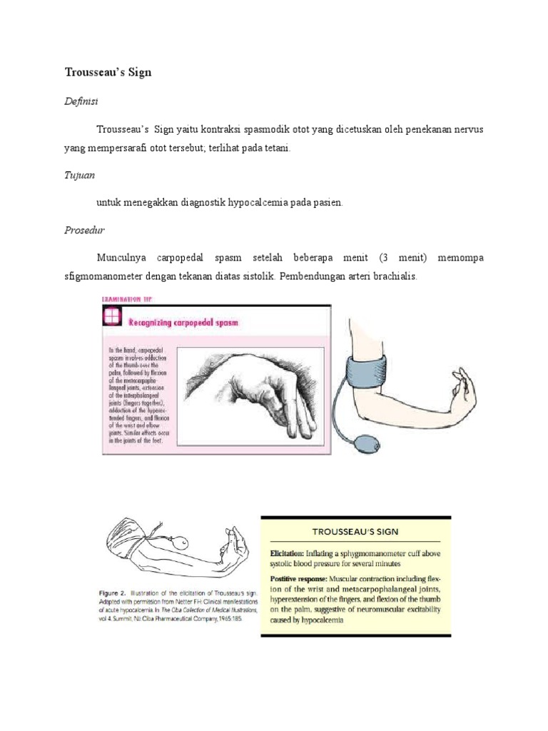 Trousseau Sign | PDF
