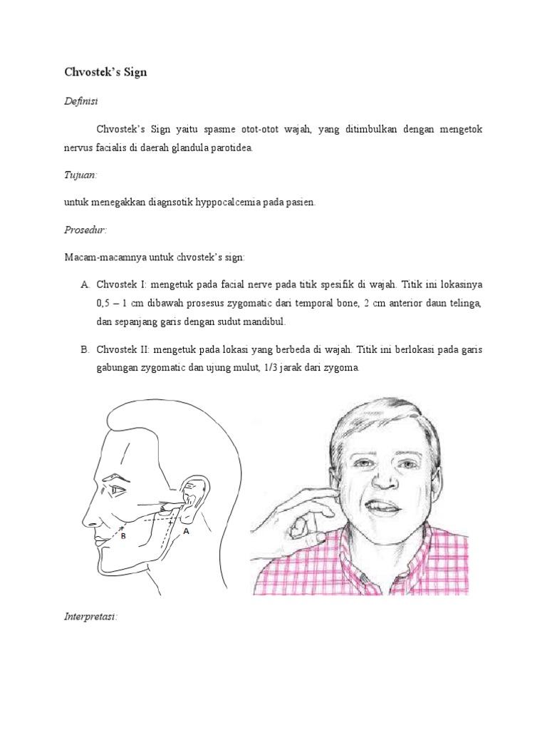 Chvostek's Sign | PDF | Sains & Matematika