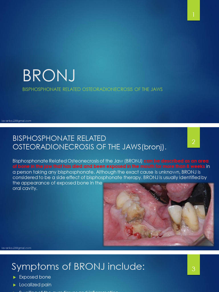 ADC Part 1 - Bronj Notes v1.0 | PDF | Diseases And Disorders | Medicine