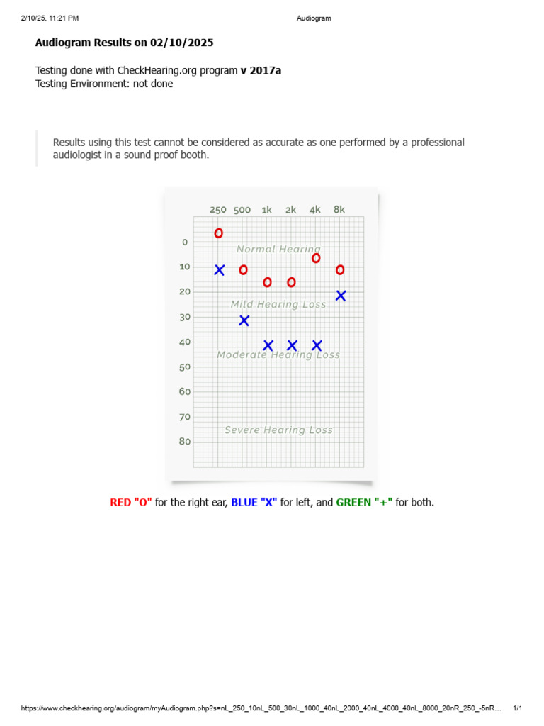 Audiogram Notes | PDF