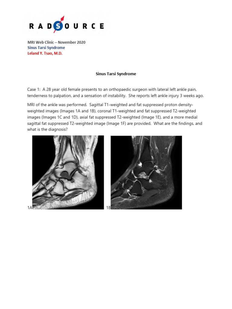 2011 Sinus Tarsi Tsao R2 FINAL | PDF | Lower Limb Anatomy | Limbs (Anatomy)