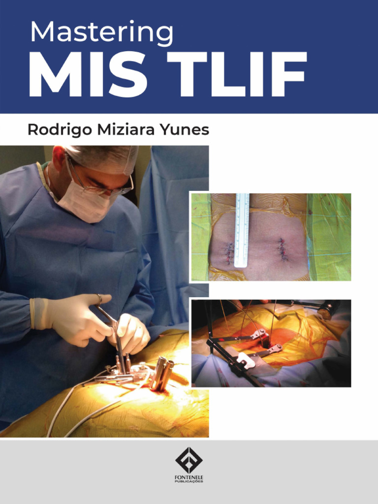 Mastering Mis Tlif - Ebook Revisado | PDF | Vertebra | Vertebral Column
